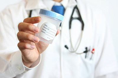 Urinalysis: What does it tell you? - Care Club